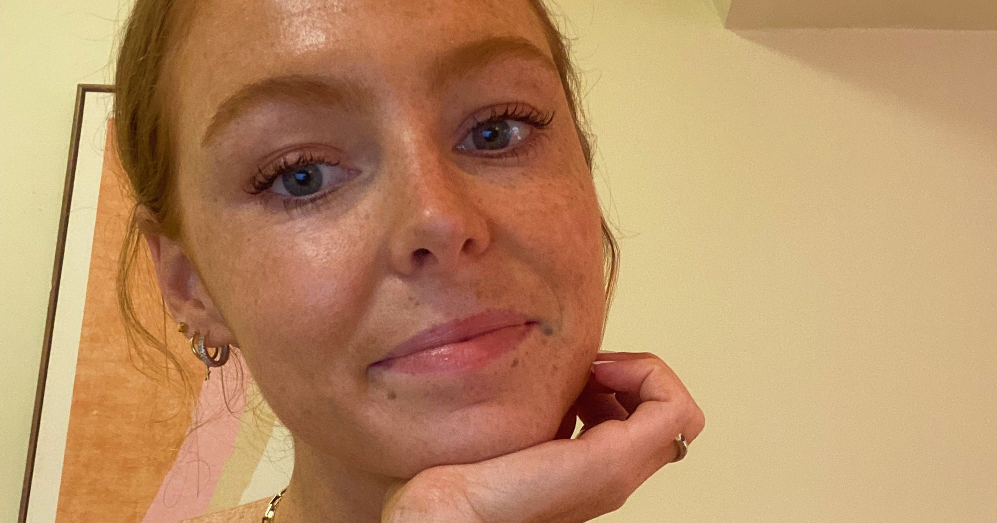 So bietest du Stirnfalten die Stirn