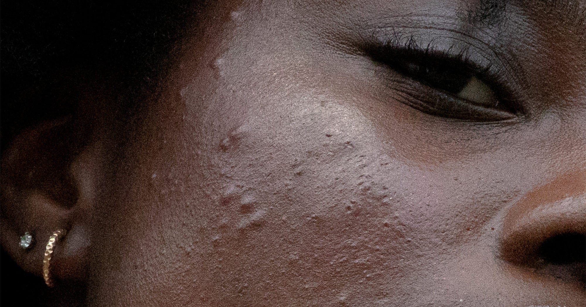 How To Treat Common Skin Conditions