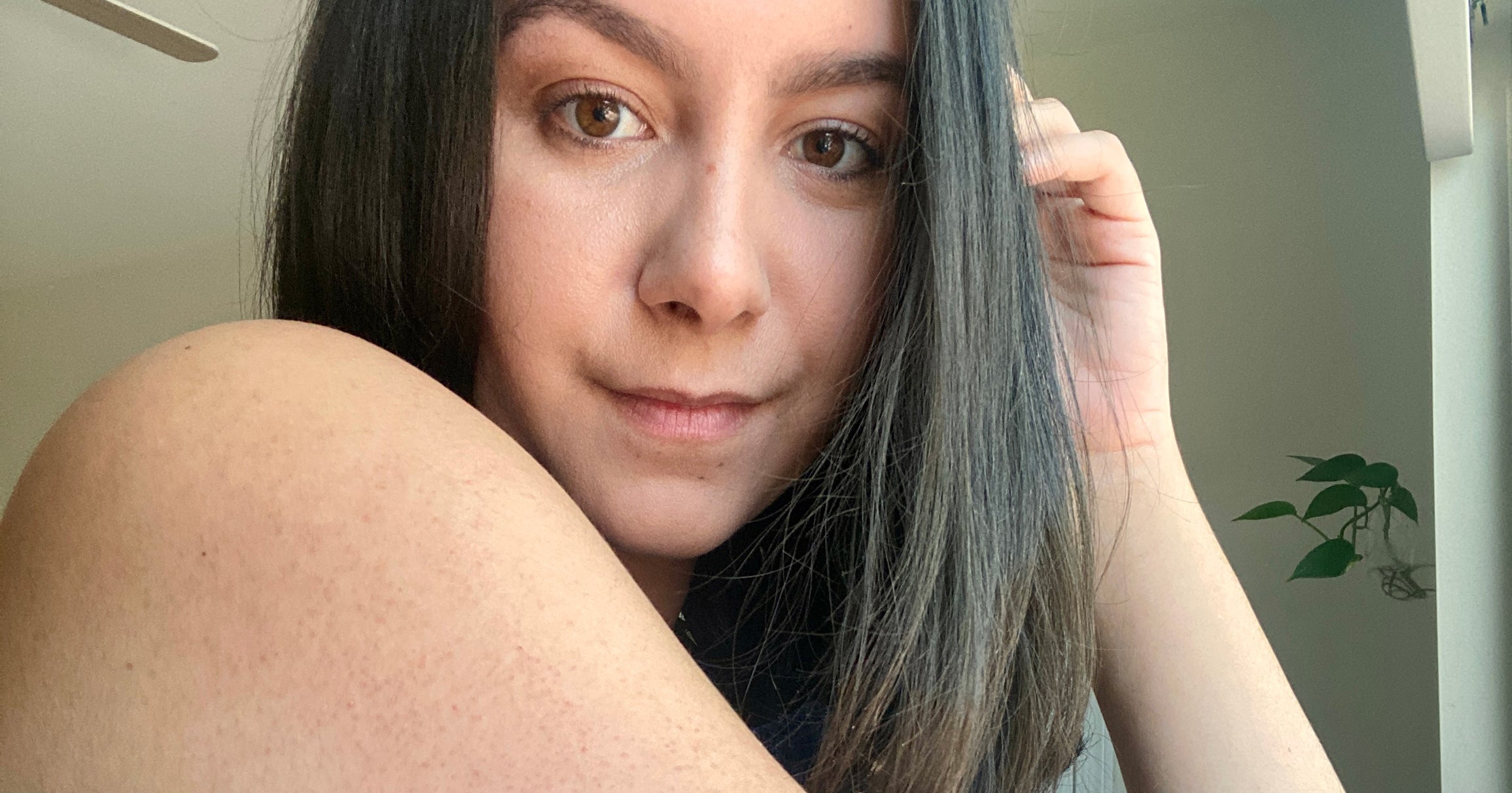 Why Keratosis Pilaris Made Me Hate Summer Fashion