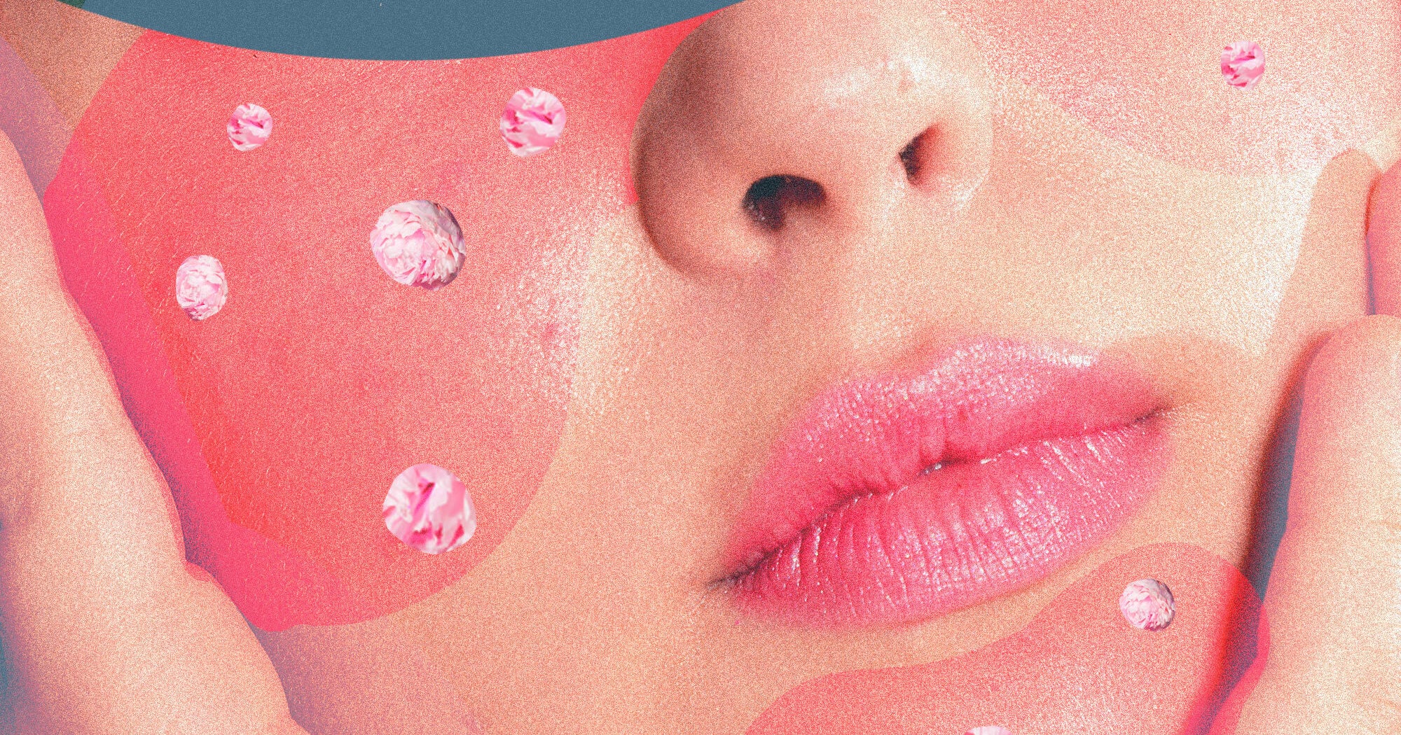 How To Treat Hyperpigmentation