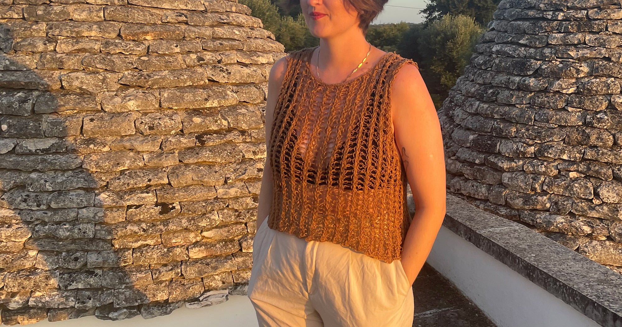 I Got Botox For Sweat - Here's What You Should Know