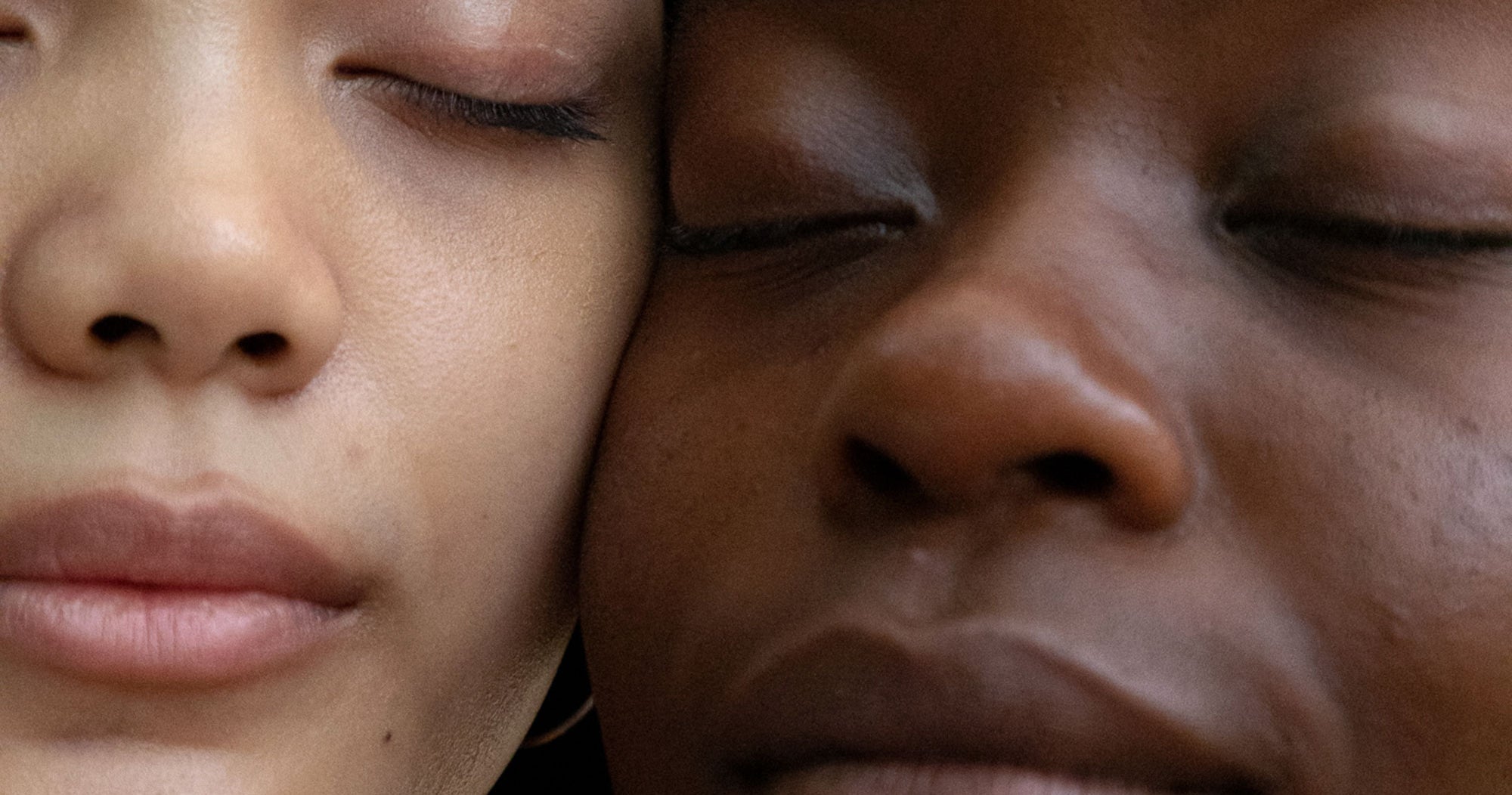 Effects Of Skin On Mental Health: Acne, Depression