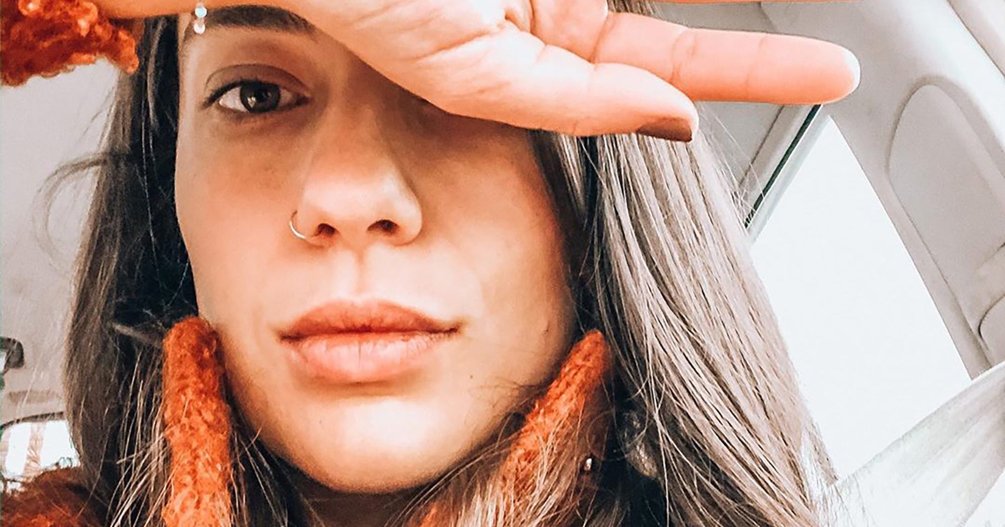 Dealing With Hyperhidrosis Excessive Sweating